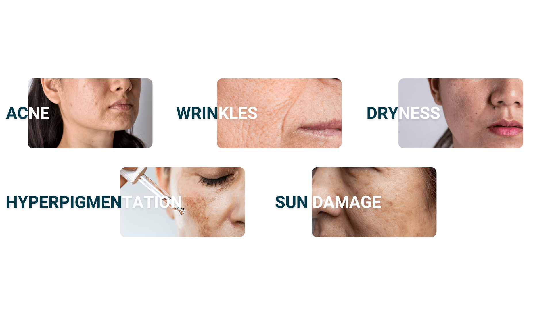 Hydrafacial - The London Obesity & Endocrine Clinic